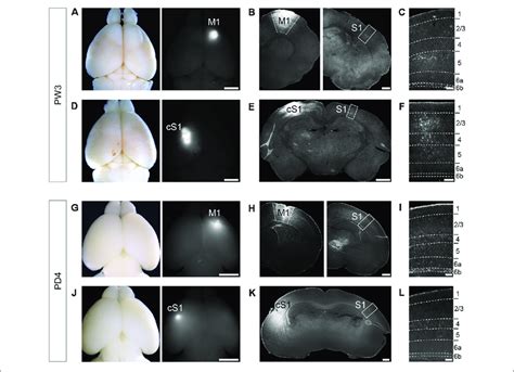 Retrograde Tracer Injection In M1 Of Pw3 Mouse Brain Labeled