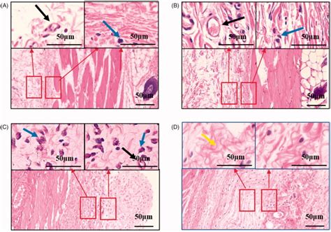 Preparation Characterization And In Vitrovivo Evaluation Of Dexamethasonepolyε Caprolactone