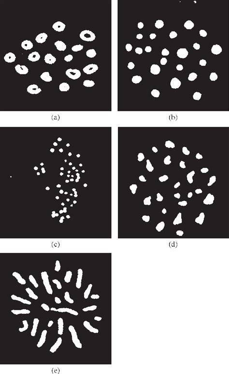 Some Typical Shapes Of Microcalcification Clusters Adapted From