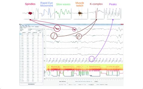 Gui Integration Of The Automatic Event Detection The Top Row Download Scientific Diagram