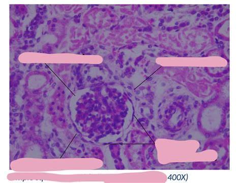 Simple Squamous Epithelium Diagram Quizlet