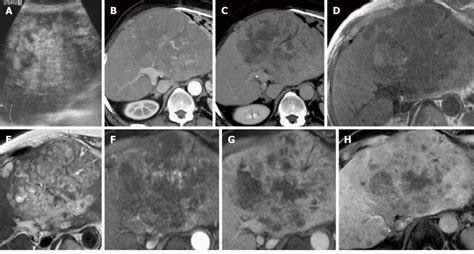 Abdominal Ultrasonography A B Mode Ultrasonography B Arterial Download Scientific Diagram
