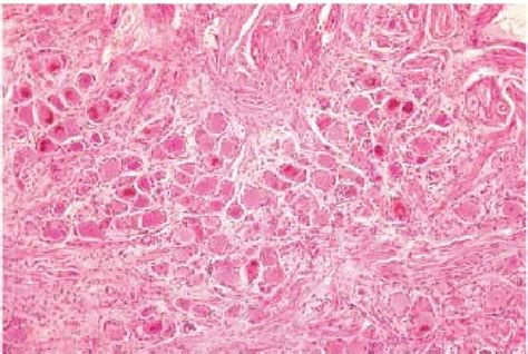 Unipolar Neuron Under Microscope