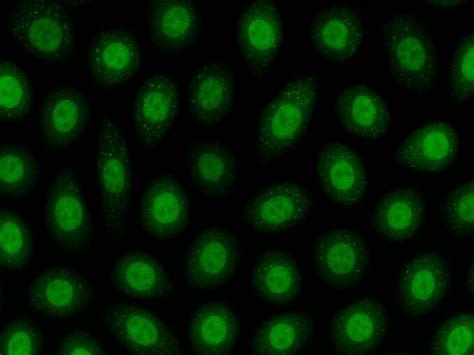 Инжекции с хиалуронова киселина в коляното и тазобедрената става имат ли полза Д р