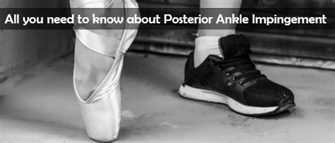 All You Need To Know About Posterior Ankle Impingement