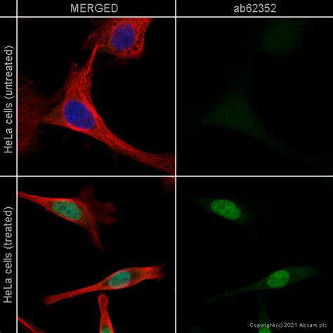 Aggresome Detection Kit Ab139486 Abcam中文官网