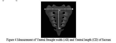 Sex Determination By Pelvis A Mini Literature Review