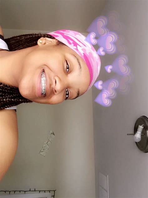 Pin By Breezy🍃 On Brace Face Getting Braces Brace Face Hair Beauty