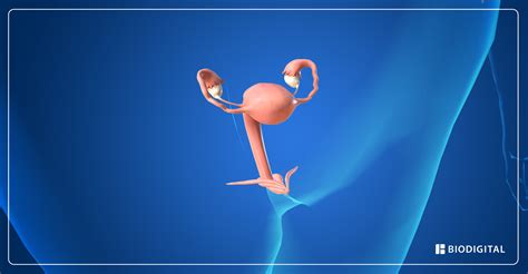 7 Pilihan Pengobatan Untuk Penderita Pcos Hello Sehat