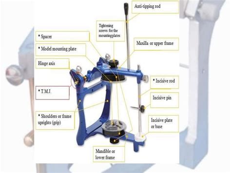 Articulators Parts Classification Limitations