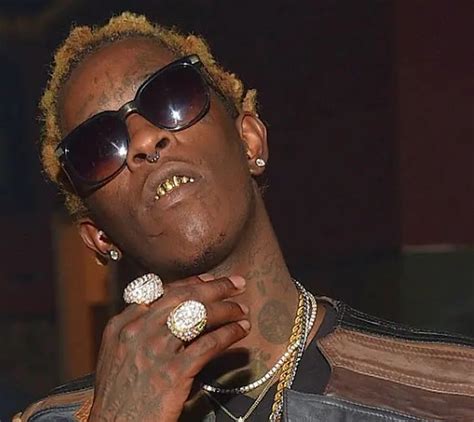 Young Thug Dişleri Eskiyeni Öncesi Ve Sonrası Lema Dental Clinic