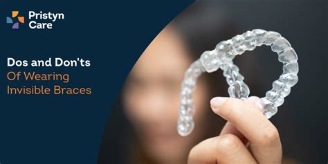 Metal Braces Dos And Don Ts At Xavier Guerard Blog