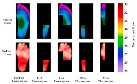 A Novel Machine Learning Approach For Severity Classification Of
