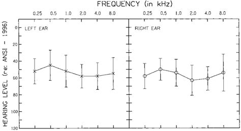 Mean Thresholds In Db Hl As A Function Of Frequency For The Left