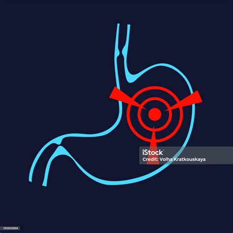 위 가슴 앓이 복통 위염 소화 불량 구토 가슴 앓이 문제 가슴 앓이와 위염은 고립 소화 불량과 복통 문제가있는 개념 벡터 플랫 0명에 대한 스톡 벡터 아트 및 기타 이미지