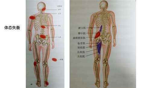 解析「髂脛束摩擦綜合徵」，教你緩解以及預防方法，遠離跑步膝 每日頭條
