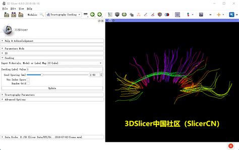 DTI教程09 纤维束成像胼胝体的参数调节 DTI 3DSlicer中文论坛