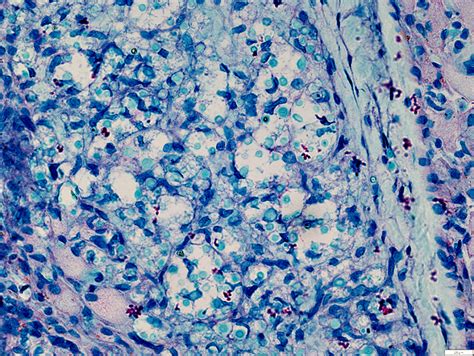 Cryptococcus