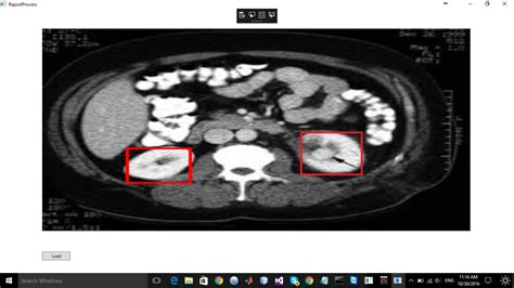 haar classifier limitations opencv qanda forum