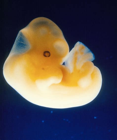 The Human Embryo At Five Weeks Of Gestation Photograph By Professors P