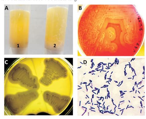 Figure 1 From Molecular Detection Of Clostridium Perfringens