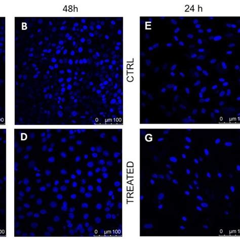 DAPI Staining Performed On Cultured Human Fibroblasts Right And HaCaT Download Scientific