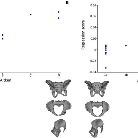 Aitken Classification Of Congenital Femoral Deficiency Download Scientific Diagram
