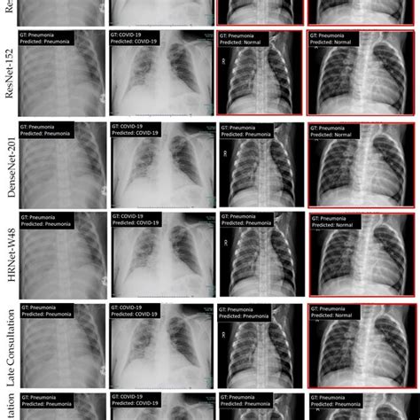 Visualization Of The Prediction Results Of Various Models Best Viewed Download Scientific