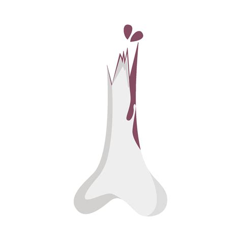 Broken Bone Illustration 36198285 Vector Art At Vecteezy