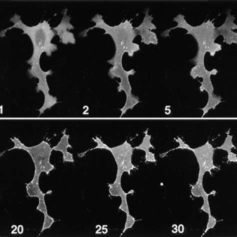 Thapsigargin Induced Translocation Of γ Pkc Gfp 5 μm Thapsigargin An Download Scientific