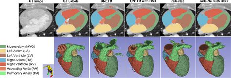 Dual Self Distillation Of U Shaped Networks For 3d Medical Image