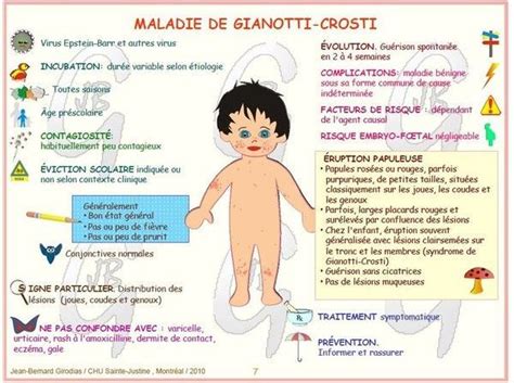 Maladie De Gianotti Crosti