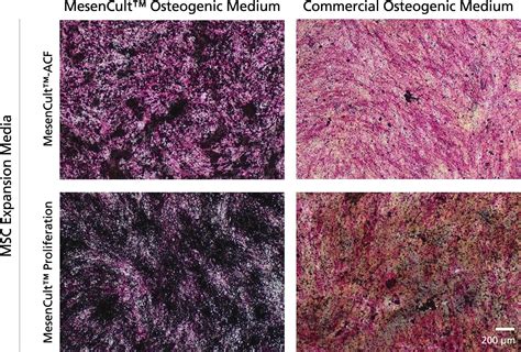 Mesencult™ Osteogenic Differentiation Kit Human Stemcell Technologies