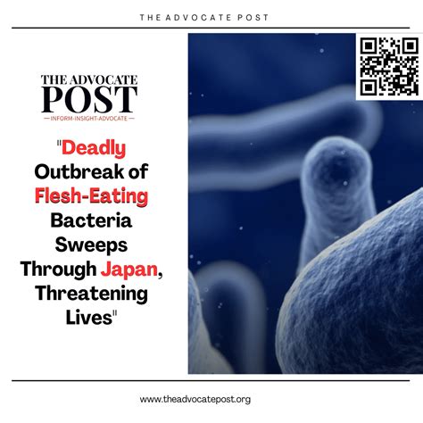 Deadly Outbreak Of Flesh Eating Bacteria Sweeps Through Japan