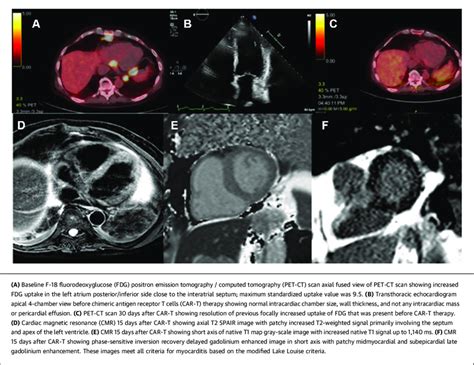 Multimodality Cardiac Imaging Download Scientific Diagram
