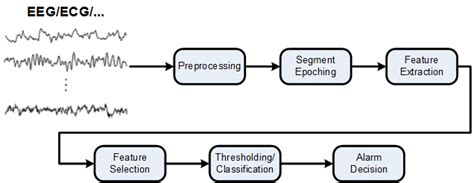 Flowchart Of Seizure Detectionprediction System Download Scientific Diagram