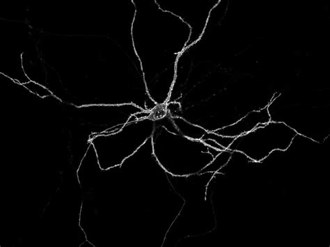 Researchers Visualize Neuron Activity