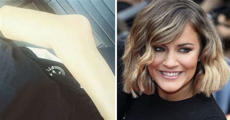 The X Ray Factor Caroline Flack Shares Grim Snap Of Her Broken Arm Daily Star