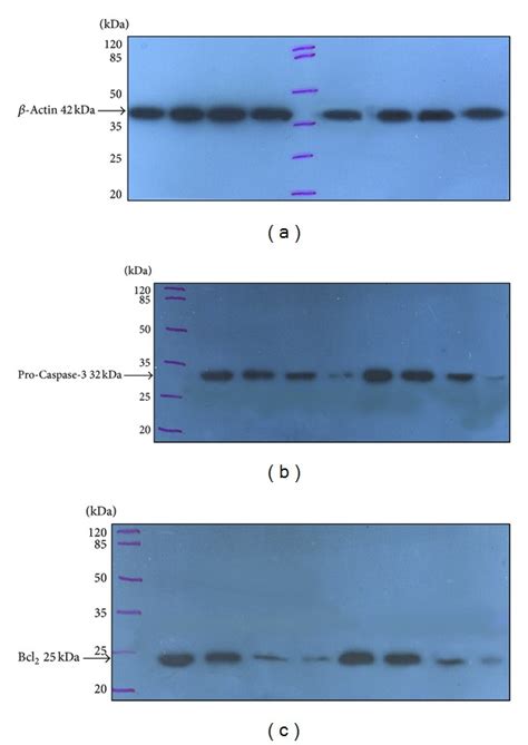 Western Blot Analysis Of A β Actin B Pro Caspase 3 And C Bcl2