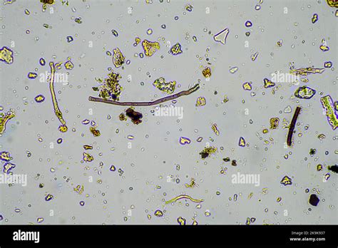 Fungal Hyphae At Mabel Burton Blog