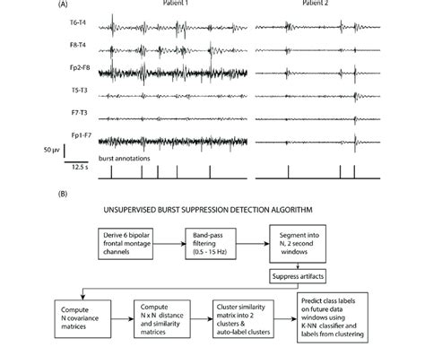 Unsupervised Burst Suppression Detection A Two Example Patients From