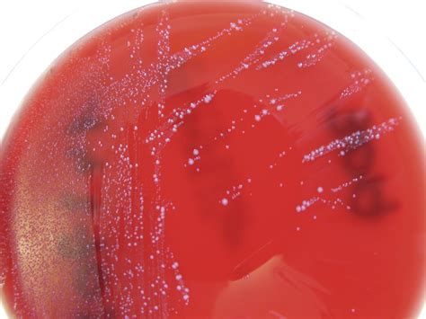 Morfologia Da Colonia De Enterococcus Faecalis Thermo Scientific Agar
