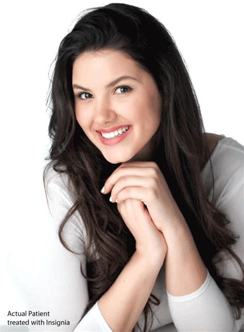 Learn About Insignia Braces At Kare Orthodontics San Rafael