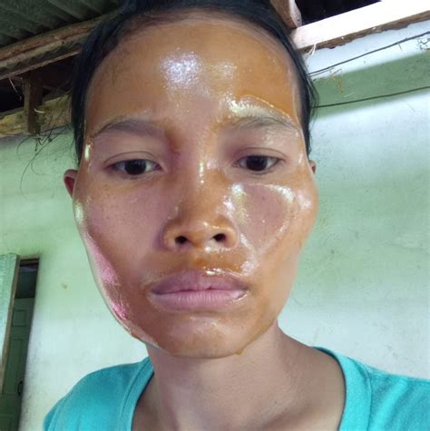 มะขามแก้ฝ้ากระ เจ๊ไก่สรรหามาแชร์