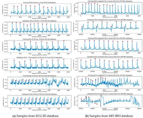 Fast And Accurate Algorithm For Ecg Authentication Using Residual Depthwise Separable