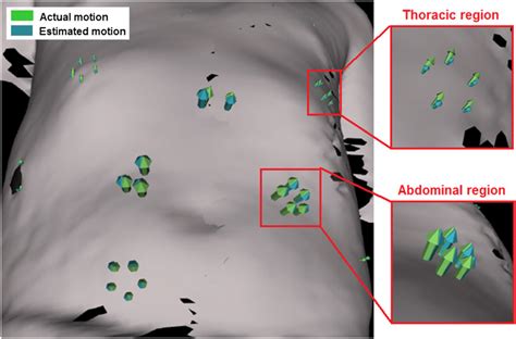 Comparison Between The Actual Motion Of The Thoracic And Abdominal