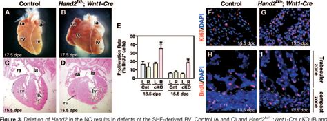 Figure 3 From Cardiac Neural Crest Expression Of Hand2 Regulates Outflow And Second Heart Field