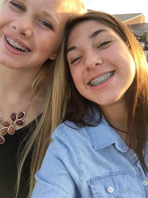 Pin By Michael Bierbaum On Orthodontic Appliances Cute Girls With