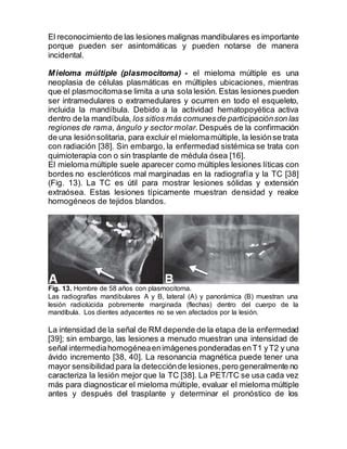 Lesiones Quisticas Y De Apariencia Quistica De La Mandibula Revision