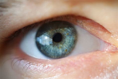 How Droopy Eyelids Can Affect Vision In Focus Surgery Blog